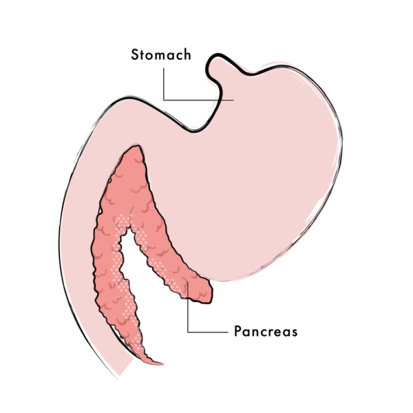 Diabetes in Cats – Medicus Veterinary Diets